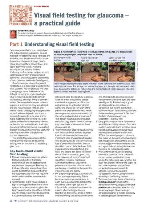 PDF Visual Field Testing For Glaucoma A Practical Guide