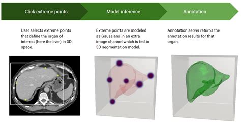 Fast Ai Assisted Annotation And Transfer Learning Powered By The Clara Train Sdk Nvidia