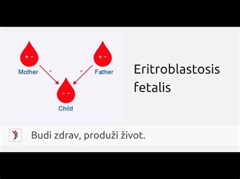 Eritroblastosis Fetalis YouTube