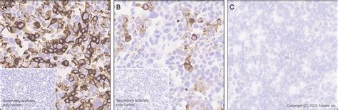 Anti Siglec5 Antibody [epr26250 156] Ab307434 Abcam