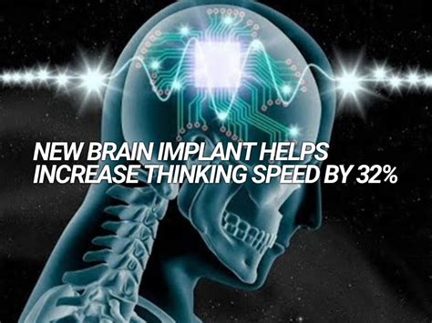 New Brain Implant Helps Increase Thinking Speed By 32 Researchers At