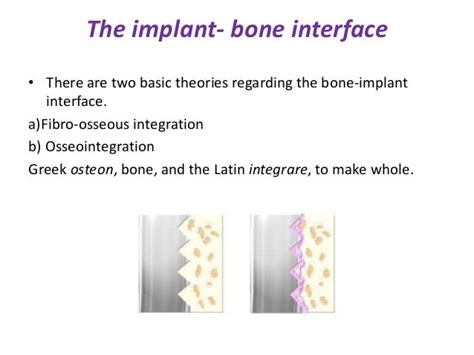 Implant Seminar