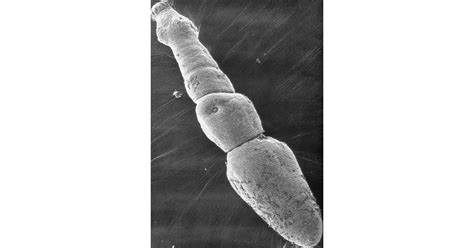 Echinococcus Multilocularis An Emerging Threat