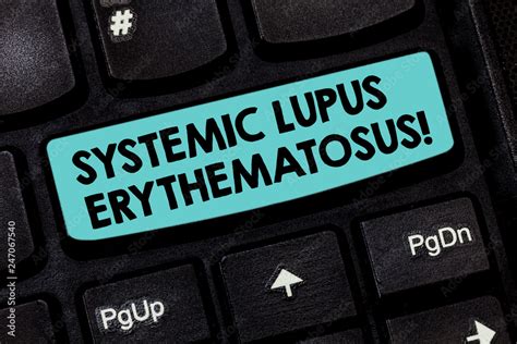 Text Sign Showing Systemic Lupus Erythematosus Conceptual Photo Immune System Of The Body