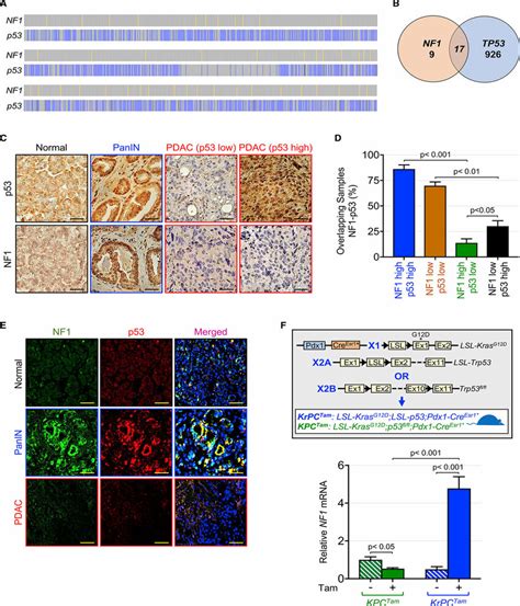 Association Between NF1 And P53 In PDAC A Oncoplot Showing Coding
