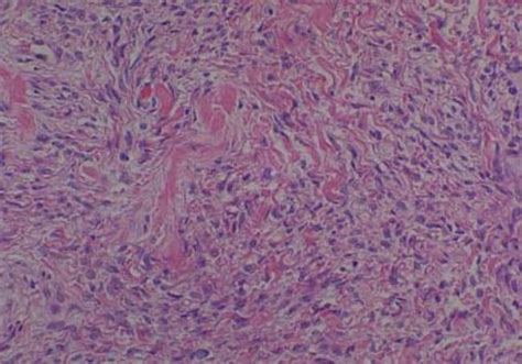 Novus Biologicals™ Human Ovary Tissue Microarray Cancer Slide Human Ovary Tissue Microarray