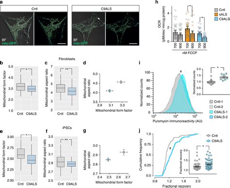 Mitochondria Morphology And Protein Synthesis In Als Patient Derived Download Scientific