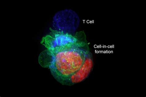 A Devious Cellular Trick Cancers Can Use To Escape Your Immune System