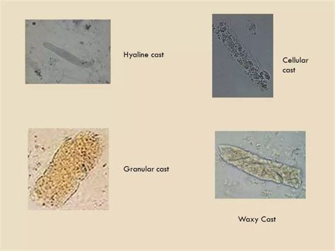 Microscopic Examination Of Urine Pptx
