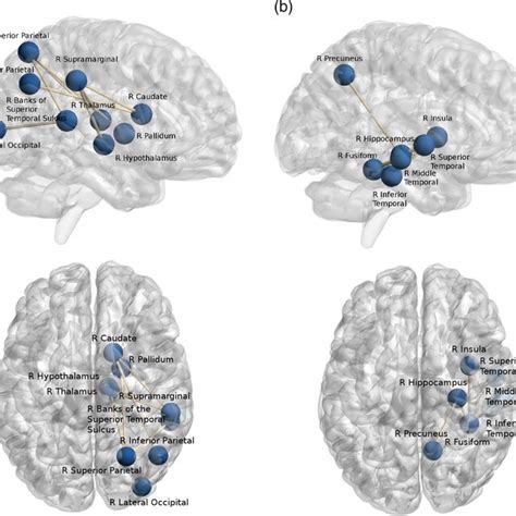 Visual Spatial Memory‐associated Networks Lesion‐based Wm Tract Download Scientific Diagram