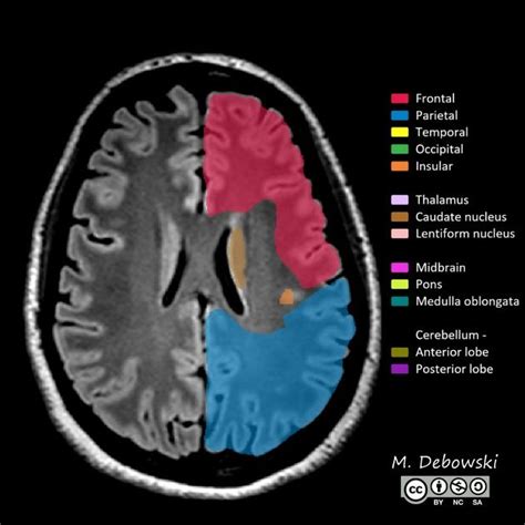 Right Cerebellar Hemisphere