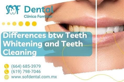 Differences Between Teeth Cleaning And Teeth Whitening Sofdental Dentist