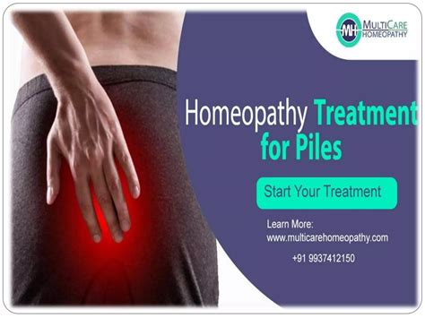 Can Homeopathy Medicine Cure Pilespptx