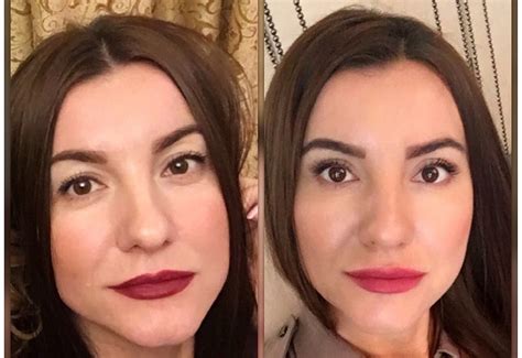 Топ 5 пластических операций которые чаще всего делают русские женщины