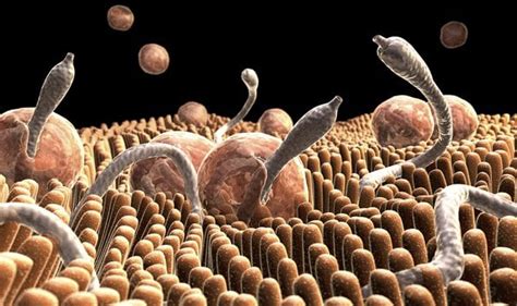 장내 기생충 종류 감염 경로 감염 증상 감염률
