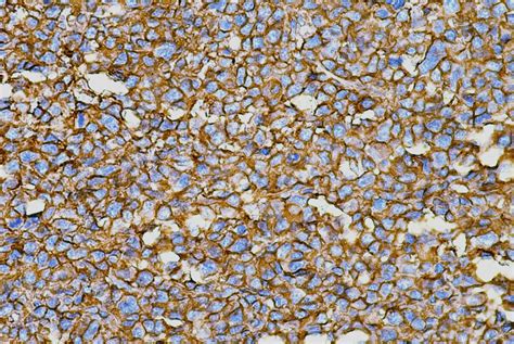 Anti Hla Class 1 Abc Biogenex