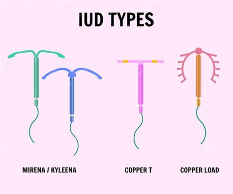 Premium Vector Intrauterine Device Types In Vector