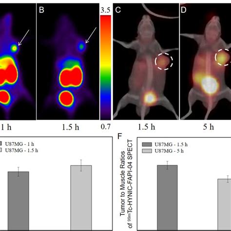 Ga FAPI PET Images Of FAP Positive Tumors At Different Time Point Download Scientific