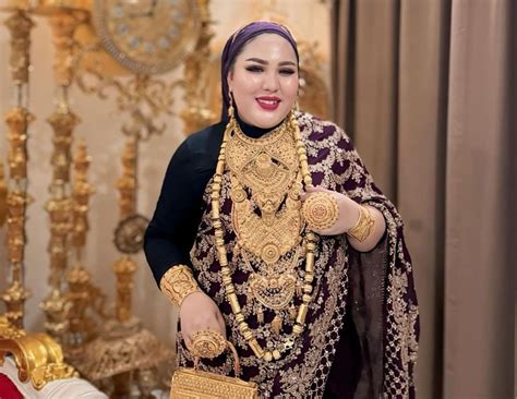 Mira Hayati Klaim Skincarenya Bisa Hilangkan Jerawat Nanah Dokter