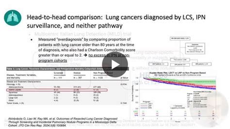 Screen Detected Sub Solid Nodules Increase Risk As A Marker Of Other Coexisting Lung Cancer