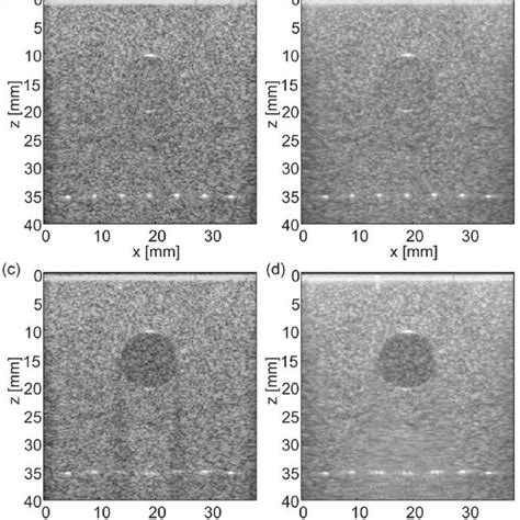 Pdf Full Correction For Spatially Distributed Speed Of Sound In Echo Ultrasound Based On