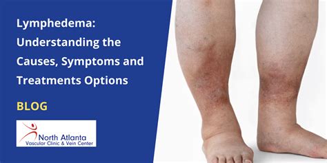 Lymphedema Understanding The Causes Symptoms And Treatments Options