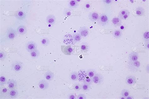 显微镜下的人类染色体实验室教育。