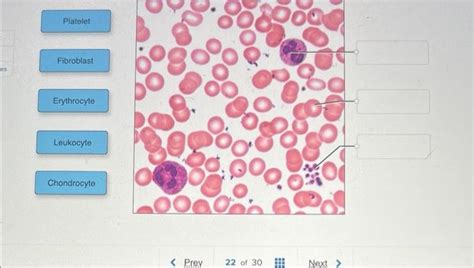 Identify The Following Tissue In The Micrograph And