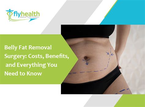 Belly Fat Removal Surgery Costs Benefits And Everything You Need To