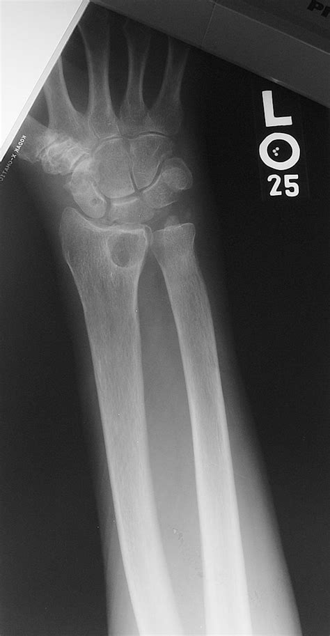 Ucsd Musculoskeletal Radiology