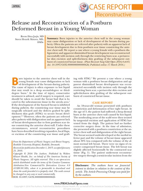 Pdf Release And Reconstruction Of A Postburn Deformed Breast In A