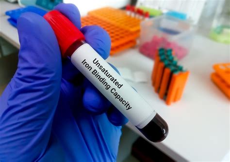 Premium Photo Unsaturated Iron Binding Capacity Or Uibc Testing