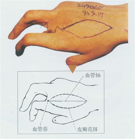 医护教育 手术图库