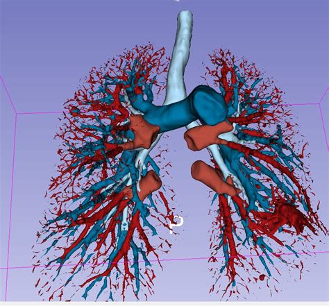 Regarding The Unexpected Segmentation Effects That Occur During Segmentation Of Lung Tissue