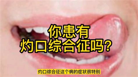 武汉蓝天胡赵煜主任有人很苦恼到底什么原因患上的灼口综合征 哔哩哔哩