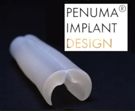 Worlds Largest Penile Implant