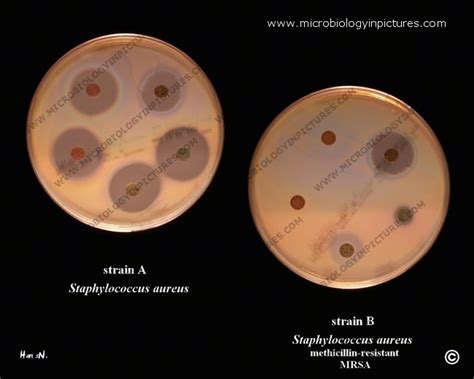 Antibiotic Susceptibility Test Staphylococcus Aureus And Mrsa