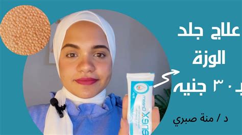 علاج جلد الوزة ب ٣٠ جنيه Youtube