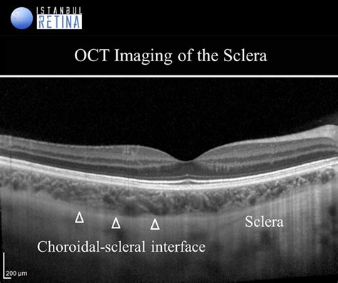 Normal OCT Anatomy OCT Club
