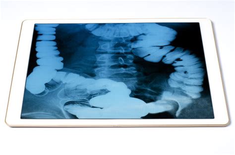 Proctitis Bilder Bläddra Bland 782 Stockfoton Vektorer Och Videor