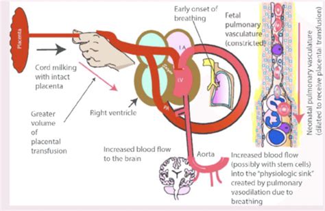 Ob Exam 3 Timing Of Umbilical Cord Clamping Flashcards Quizlet