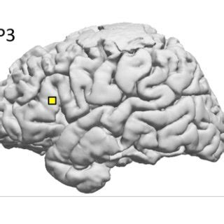 Electrode Positions For Each Of The Three Human Participants Red ECoG Download Scientific