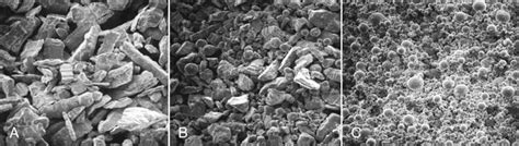 5 Dental Amalgam Pocket Dentistry