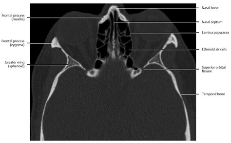 Cross Sectional Computed Tomography And Magnetic Resonance Imaging