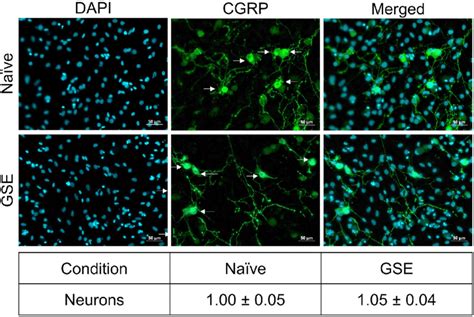 Cgrp Immunostaining Levels In Trigeminal Neurons Are Not Altered By Download Scientific Diagram