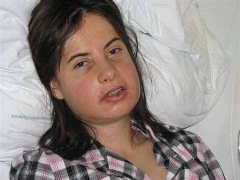 Moje Putovanje Kroz Operaciju Celjusti Siječnja 2010