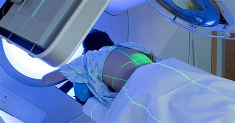 Skin Cancer Breakthroughs In Radiation Oncology