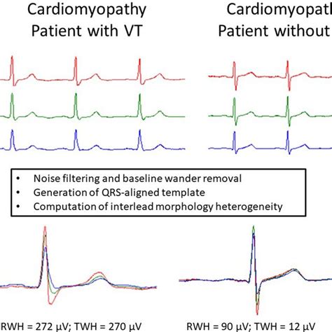 Flowchart Of Signal Processing And Computing Of The Second Central Download Scientific Diagram