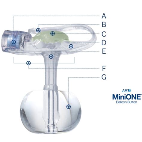 Buy Amt Mini One Balloon Button G Tube