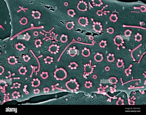 Mycoplasma Infection Coloured Scanning Electron Micrograph Sem Of